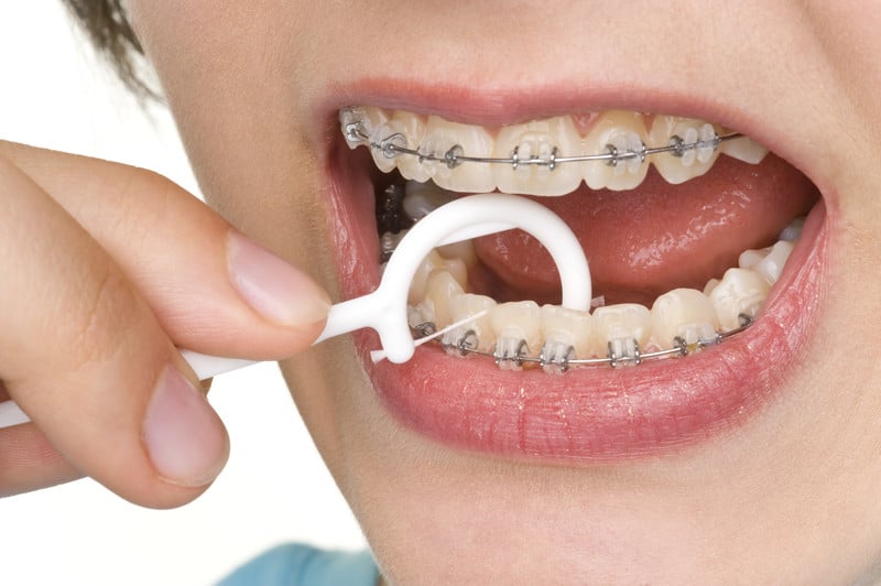 Oral Hygiene: Brushing and Dental Floss for Teeth Cleaning
